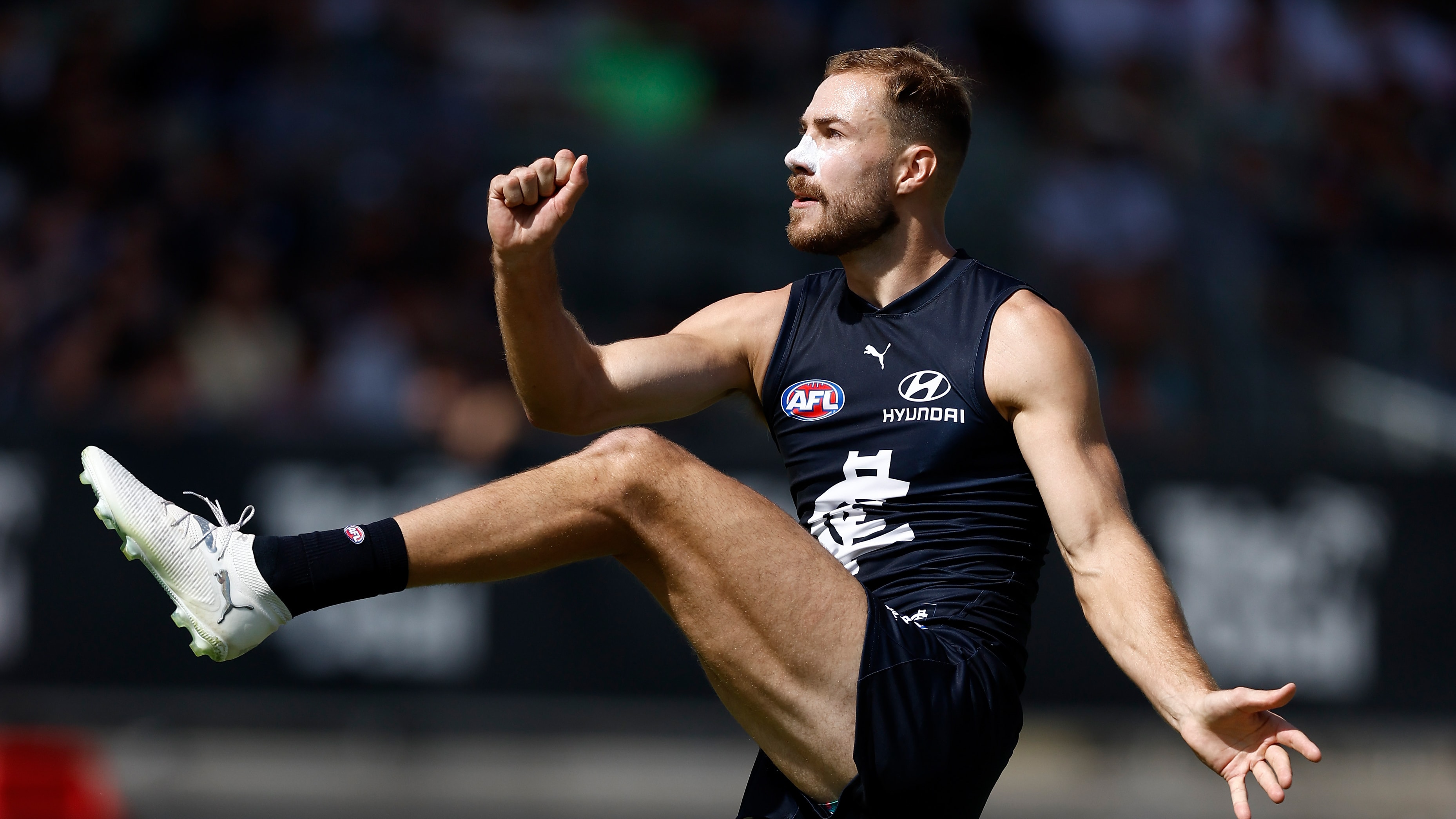 McKay ruled out of Friday night
