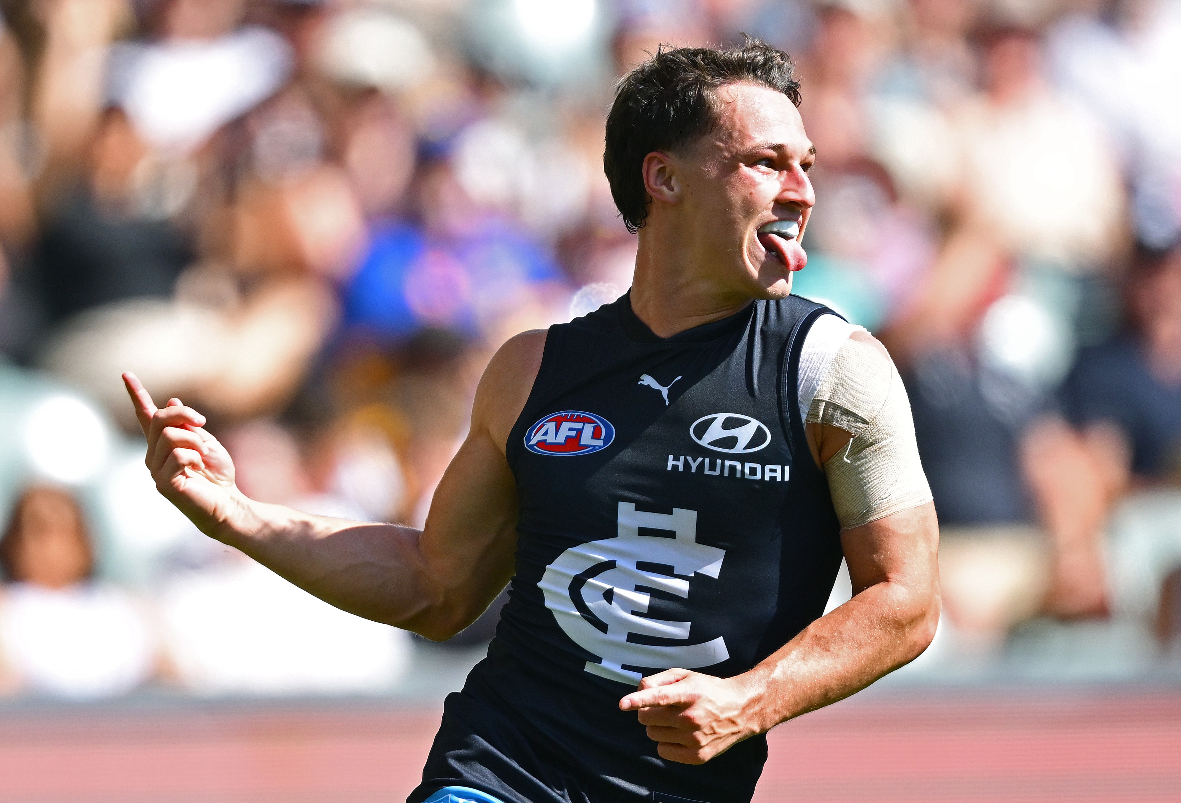Durdin: I like to be the underdog